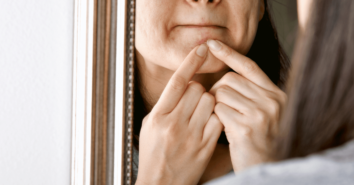 Excoriation Disorder