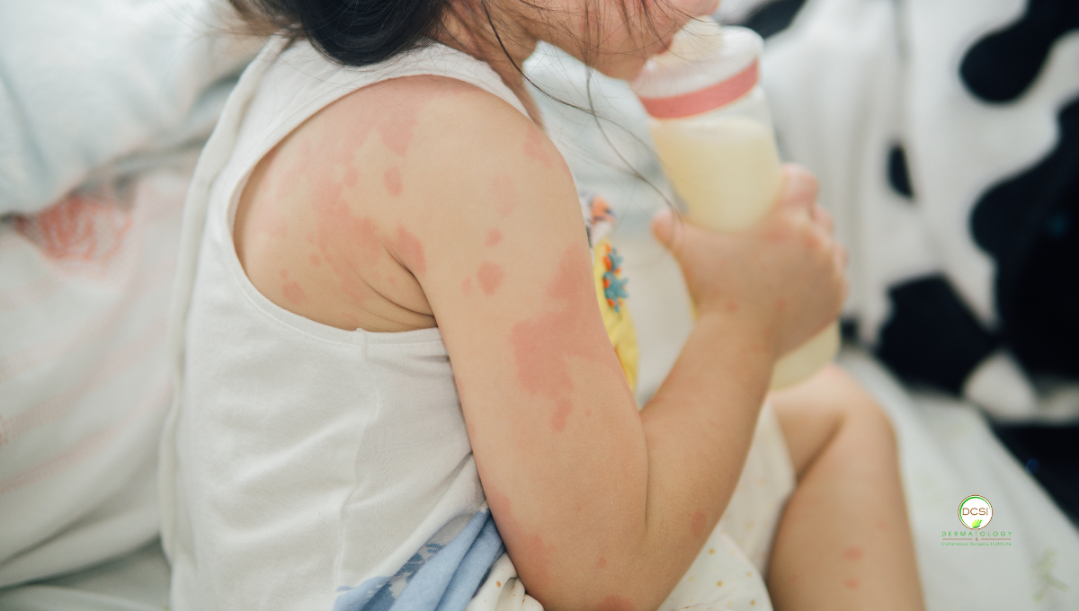 Pediatric Skin Conditions: What Parents Should Know | DCSI