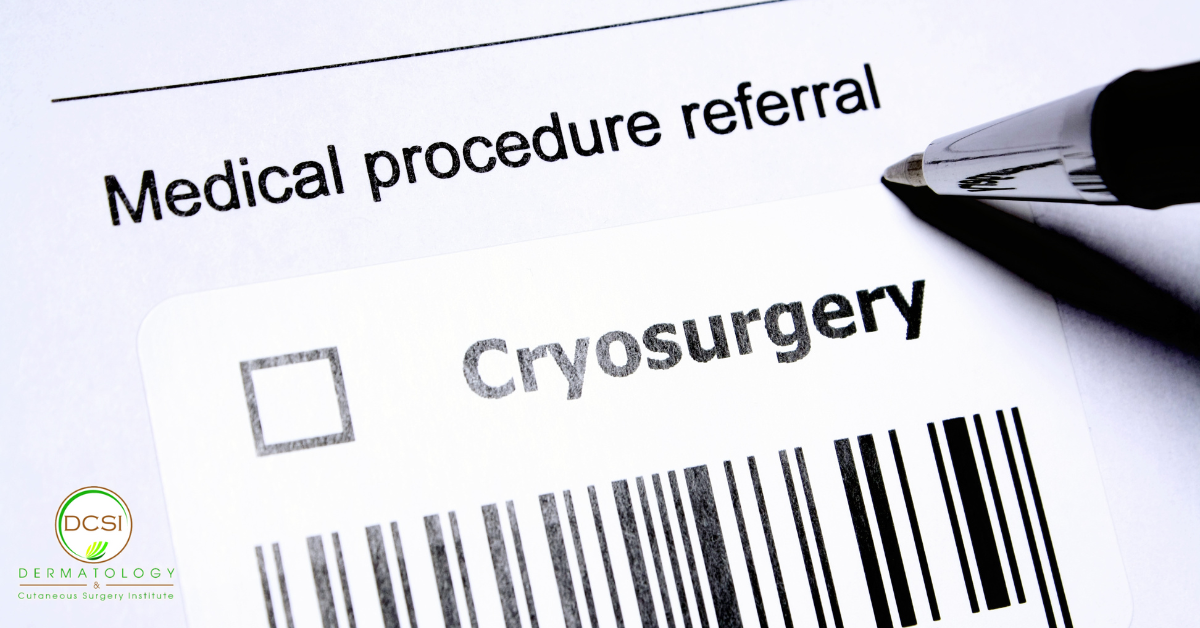 Cryosurgery in Palm Beach County | DCSI Dermatology