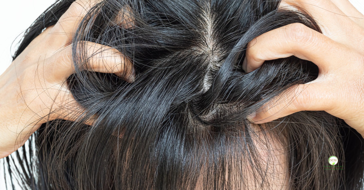Scalp Conditions: Causes, Symptoms & Treatment | DCSI